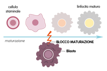Leucemie Acute - Le malattie del sangue - Fondazione Gimema